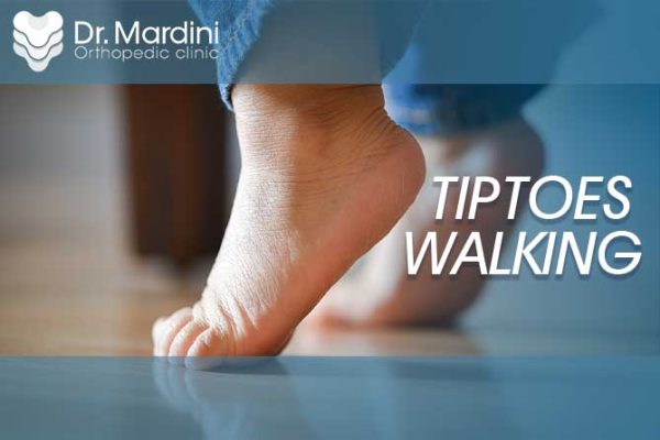 Tiptoes walking - Dr Issam Mardini